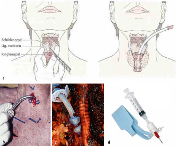 Notfallmedizin up2date | SpringerLink