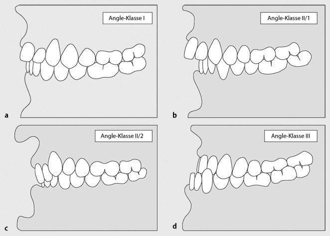 Bissverletzungen und Bissspuren | SpringerLink