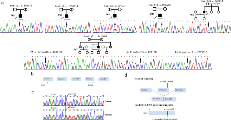 Novel mutations of CLCN7 cause autosomal dominant osteopetrosis type II ...