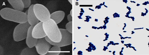Isolation and characterization of the equol-producing bacterium Slackia ...