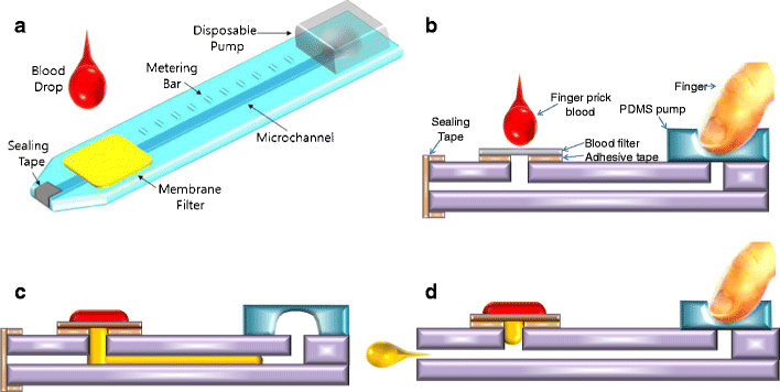 A smart pipette for equipment-free separation and delivery of plasma ...