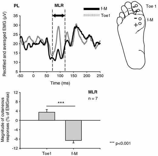 Location specificity of plantar cutaneous reflexes involving lower limb ...