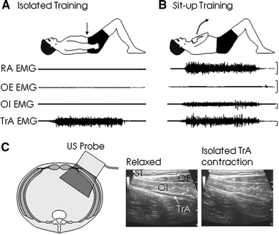 Immediate changes in feedforward postural adjustments following ...