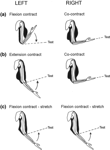 Muscle thixotropy as a tool in the study of proprioception | SpringerLink
