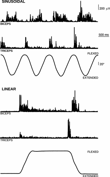 Electromyographic assessment of paratonia | SpringerLink