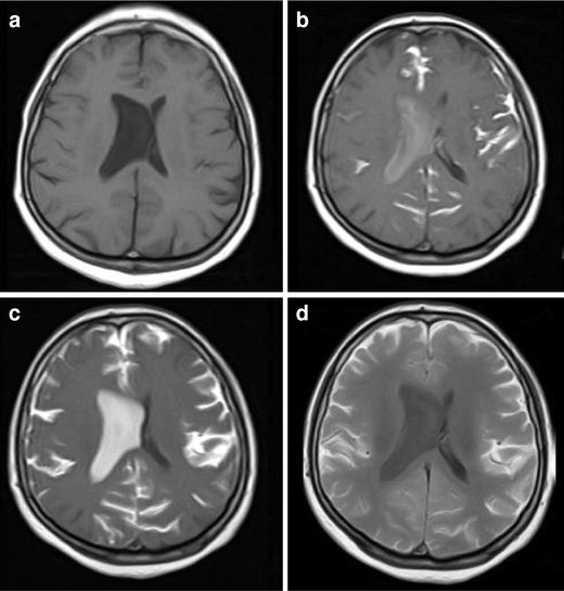 Phase-contrast cine MRI versus MR cisternography on the evaluation of ...