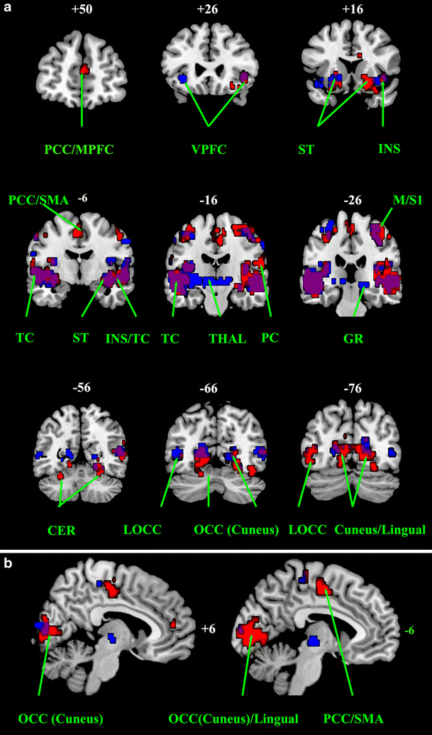 Functional connectivity of the superior human temporal sulcus in the ...
