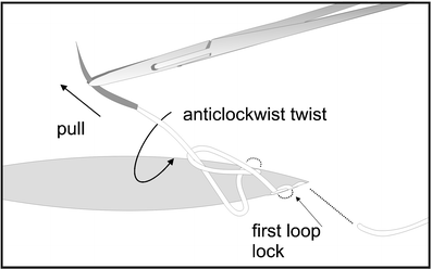 A novel technique in securing the subcuticular suture—“Loop & Lock ...