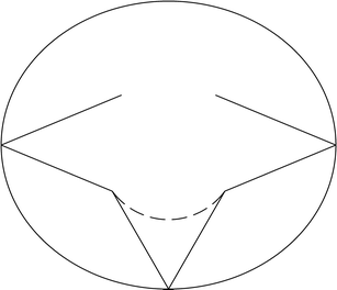 Triple-V flap: nipple reconstruction using a modified C-V flap ...