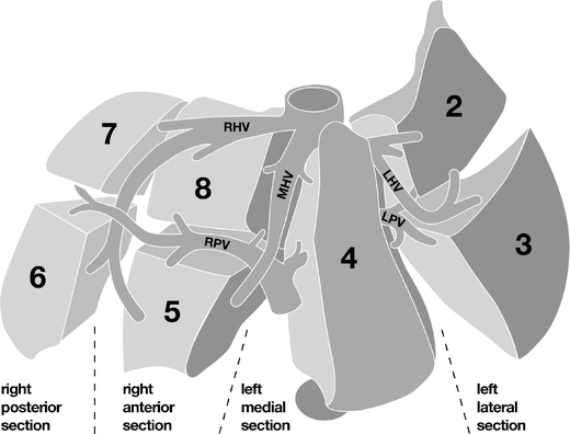 Radiological staging in children with hepatoblastoma | SpringerLink