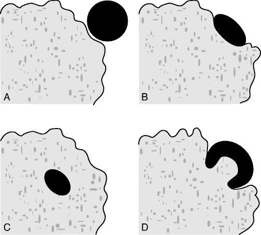 Radiological staging in children with hepatoblastoma | SpringerLink