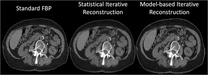 Iterative Reconstruction How It Works How To Apply It Springerlink