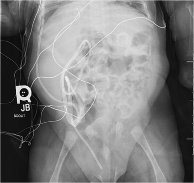 Evaluation of pediatric VCUG at an academic children’s hospital: is the ...