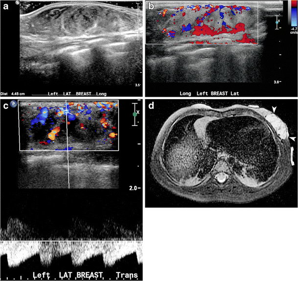 Pediatric chest ultrasound: a practical approach | SpringerLink
