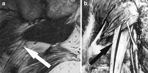 Surgical evaluation of magnetic resonance imaging findings in ...