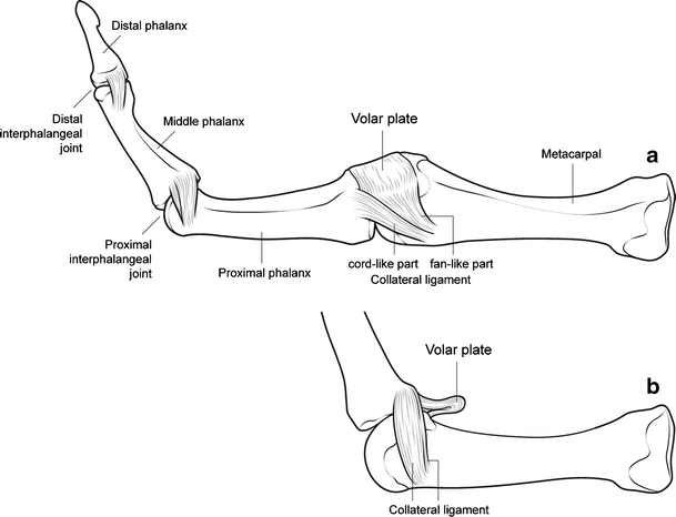Ultrasound findings of the locked metacarpophalangeal joint | SpringerLink