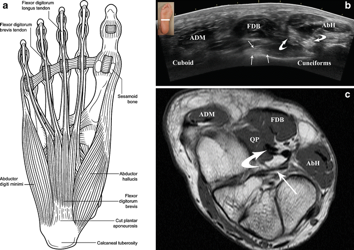 Musculoskeletal sonography of the normal foot | SpringerLink