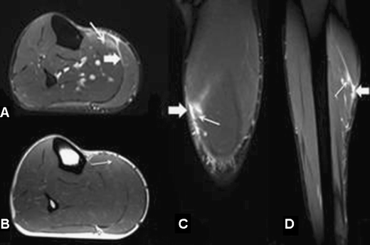 The soleus muscle: MRI, anatomic and histologic findings in cadavers ...