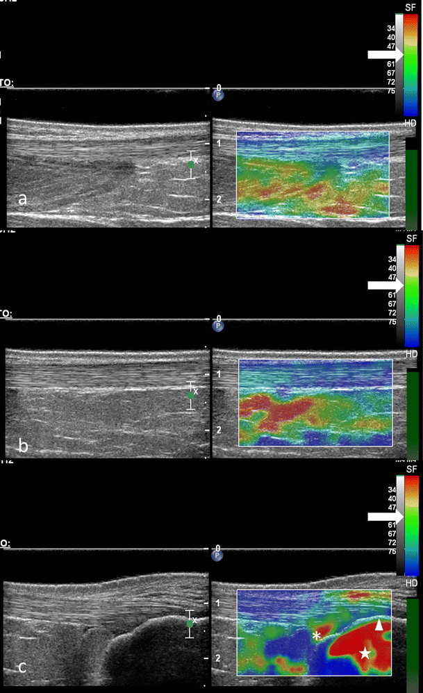 “Soft, hard, or just right?” Applications and limitations of axial ...