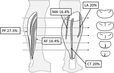 Soleus muscle injury: sensitivity of ultrasound patterns | SpringerLink