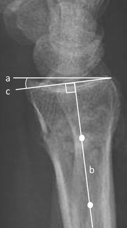Comparison of 2D radiography and a semi-automatic CT-based 3D method ...