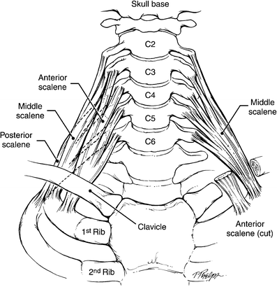 Scalene muscle uptake: a potential pitfall in head and neck PET/CT ...