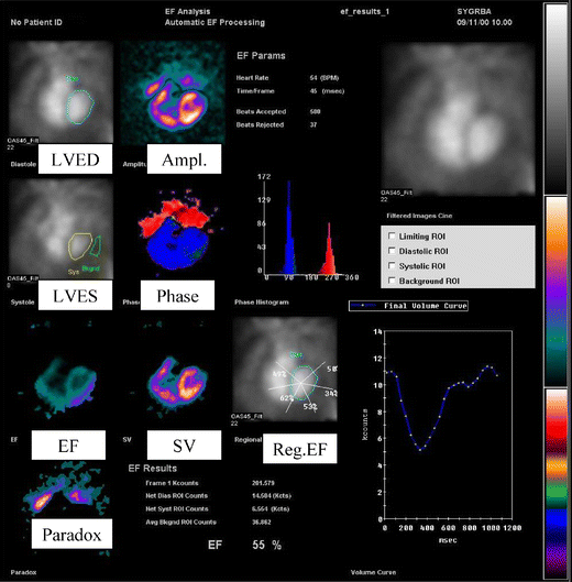EANM/ESC guidelines for radionuclide imaging of cardiac function ...