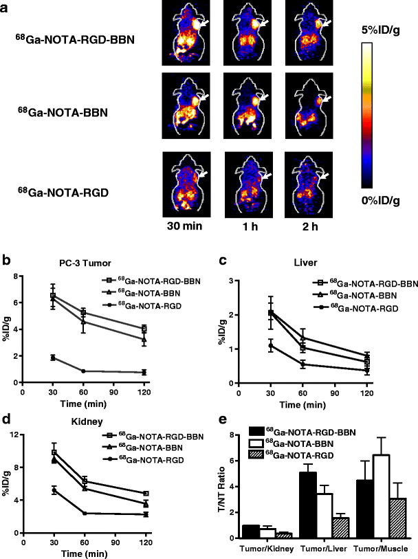 68Ga-labeled NOTA-RGD-BBN peptide for dual integrin and GRPR-targeted ...