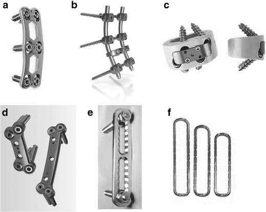Bone SPECT/CT in the postoperative spine: a focus on spinal fusion ...
