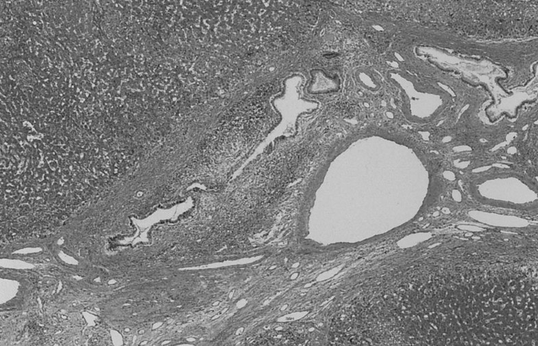 MRI findings of primary biliary cirrhosis: correlation with Scheuer ...
