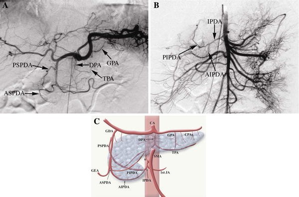 Arterial supply to the pancreas; variations and cross-sectional anatomy ...