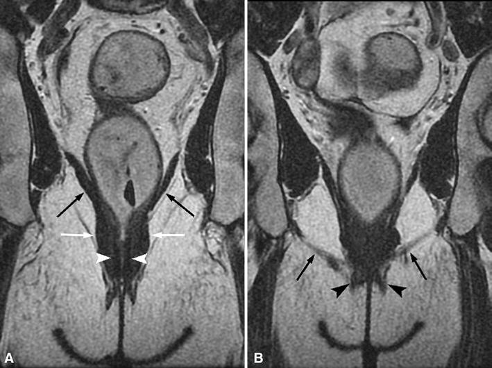 Dynamic pelvic floor imaging: MRI techniques and imaging parameters ...