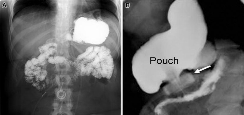 Imaging obese patients: problems and solutions | SpringerLink