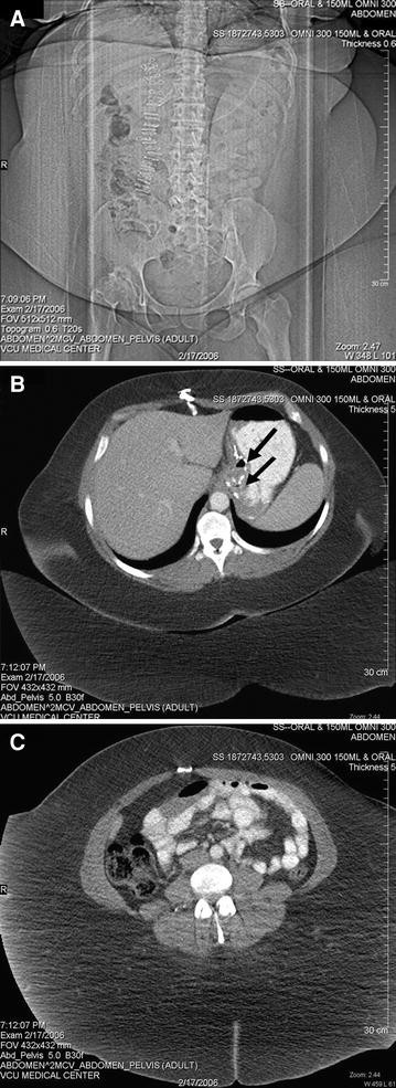 Imaging obese patients: problems and solutions | SpringerLink