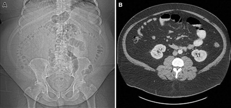 Imaging obese patients: problems and solutions | SpringerLink