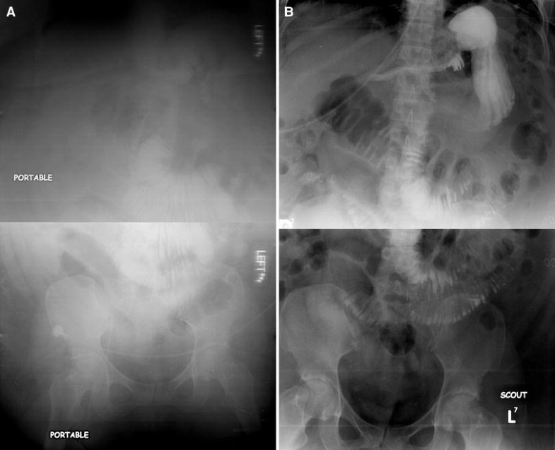 Imaging obese patients: problems and solutions | SpringerLink