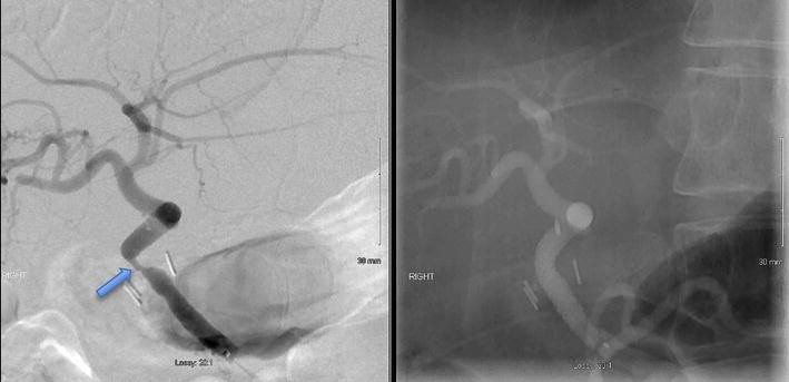‘Tardus-Parvus’ waveform | SpringerLink
