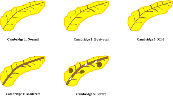 Surgical approaches to chronic pancreatitis: indications and imaging ...