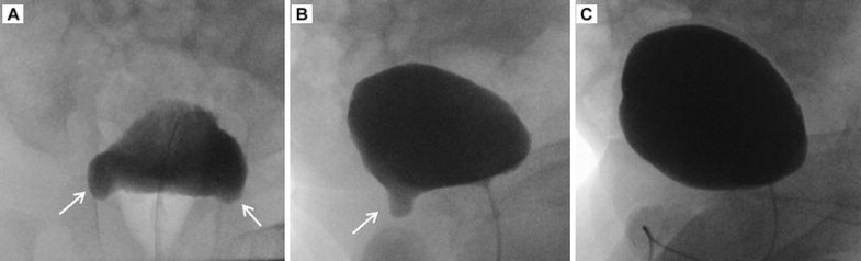 The “Bladder ear” | SpringerLink