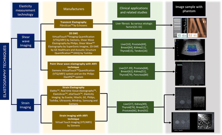 Principles of ultrasound elastography | SpringerLink