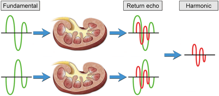 Imaging with ultrasound contrast agents: current status and future ...