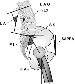 Influence of the sagittal balance of the spine on the anterior pelvic ...