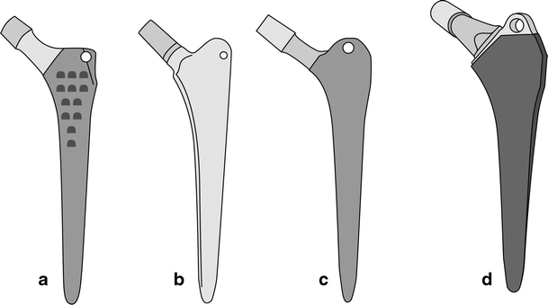 Radiological identification of Zweymüller-type femoral stem prosthesis ...