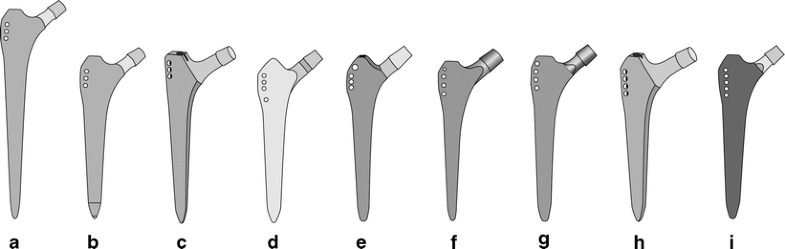 Radiological identification of Zweymüller-type femoral stem prosthesis ...
