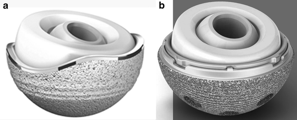 Early experience with dual mobility acetabular systems featuring highly ...