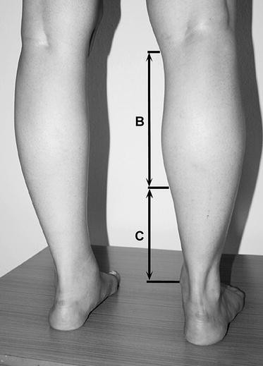 Determination of Normal Calf and Ankle Values Among Medical Students ...