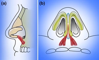 Effect of the Depressor Septi Nasi Muscle Modification on Nasal Tip ...