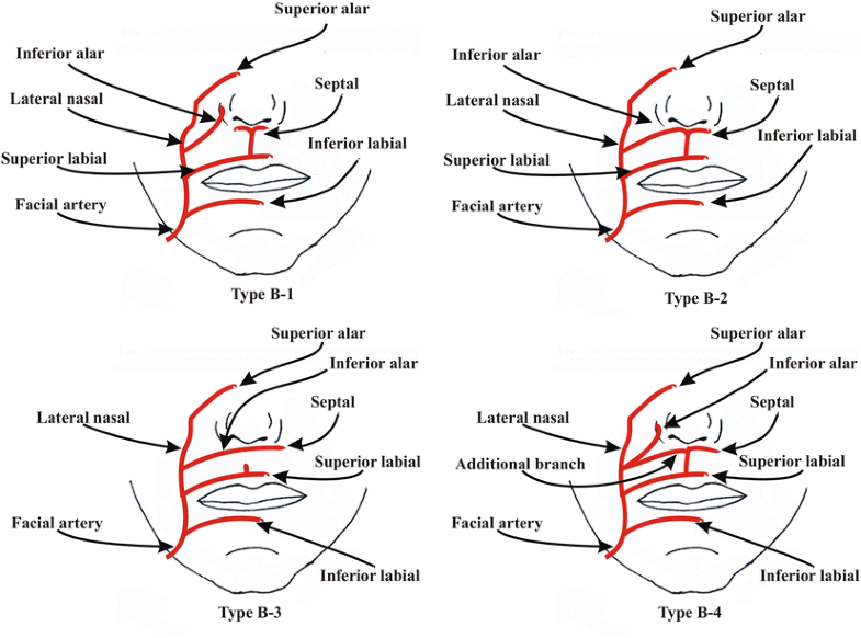 A detailed observation of variations of the facial artery, with ...