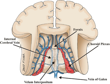 The velum interpositum revisited and redefined | SpringerLink