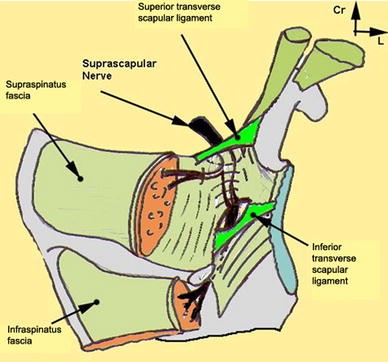 Anatomical basis of the suprascapular nerve entrapment, and clinical ...